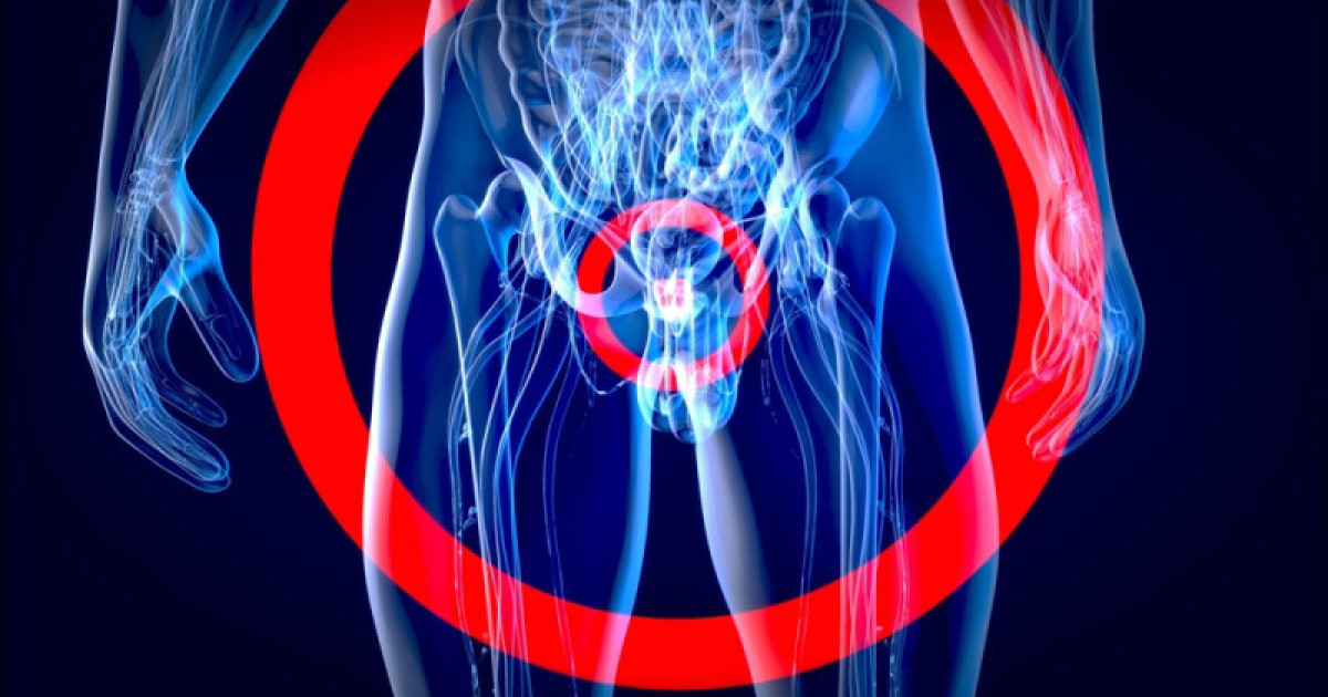 Prostate cancer: the key questions to ask when facing a diagnosis